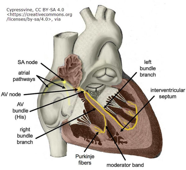 Contraindications to MLD - Lymphedema Therapy Source